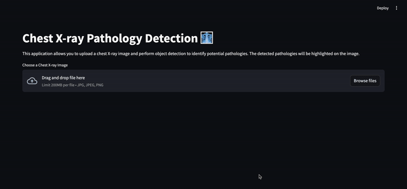 Chest X Ray Detection App Hippolyte Mayard”